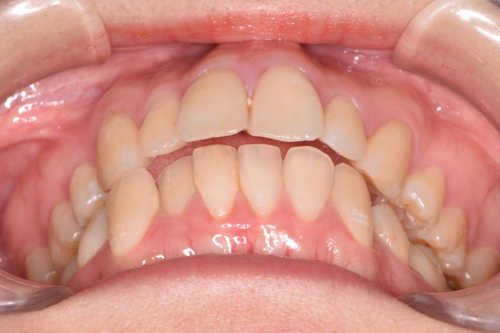 0000000003 | 札幌の矯正歯科egao