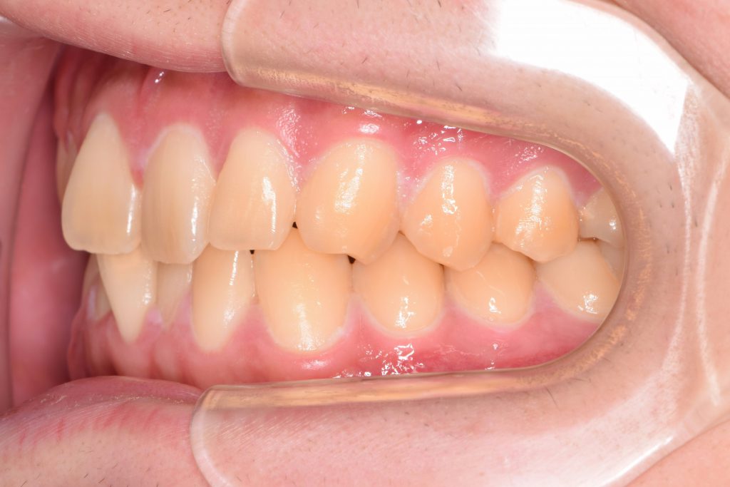 0000000003 | 札幌の矯正歯科egao