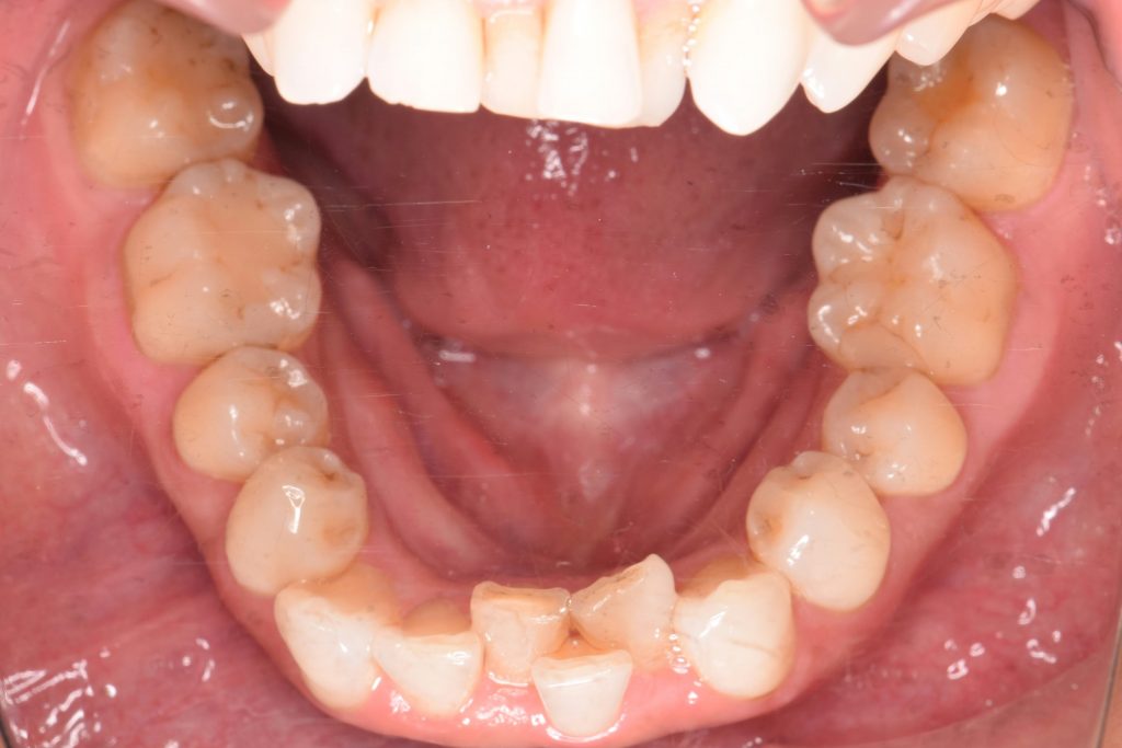 0000000004 | 札幌の矯正歯科egao