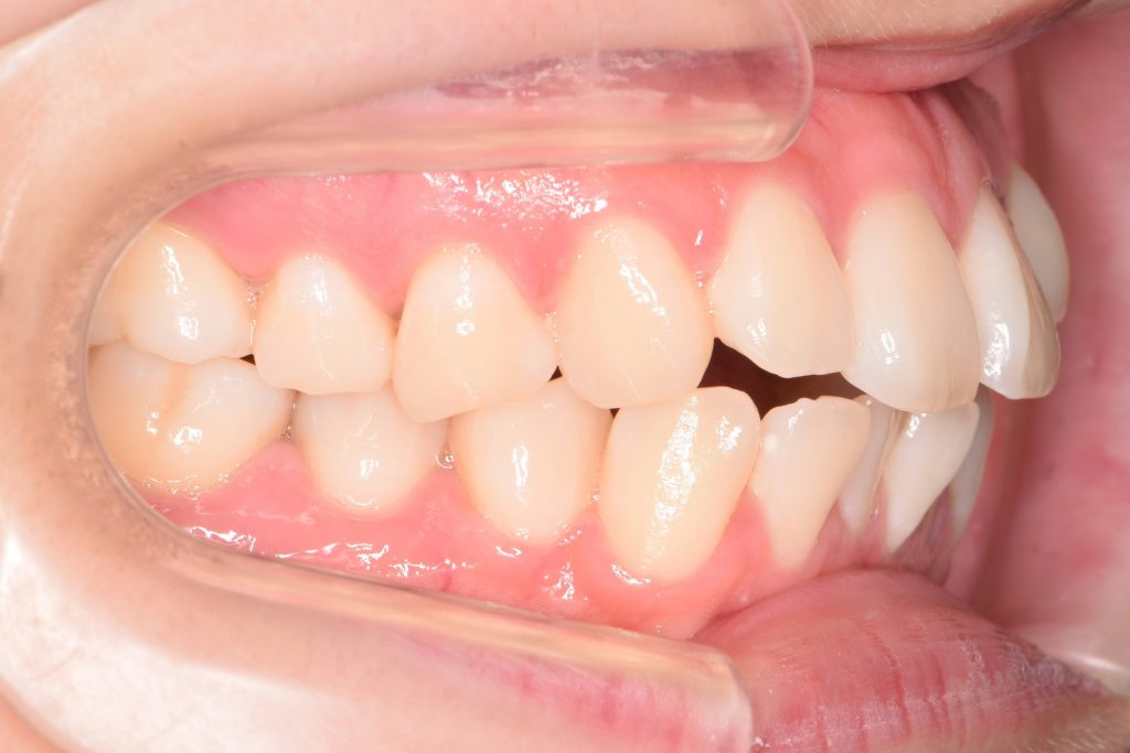 0000000004 | 札幌の矯正歯科egao